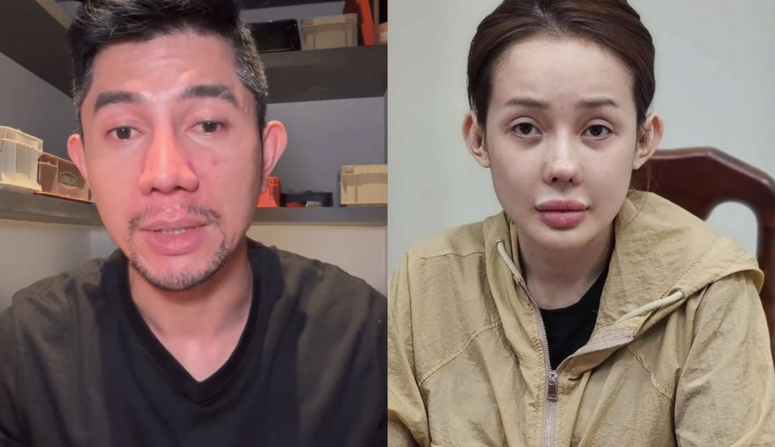 Lương Bằng Quang ám ảnh vì lời dự báo tù tội, chia sẻ mũi của Ngân 98 đang bị hoại tử